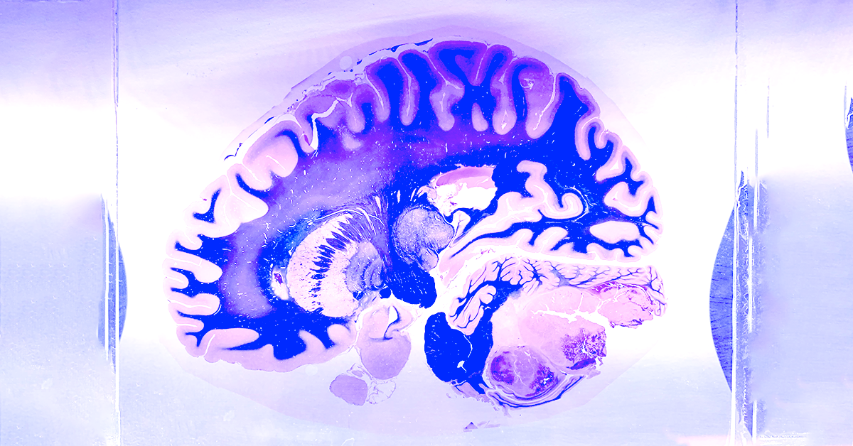 History, Science, and Ethics at the Cushing Center Brain Collection